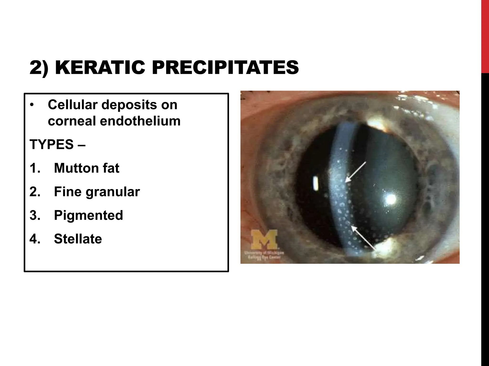 INVESTIGATIONS FOR UVEAL TRACT DISEASES.pptx