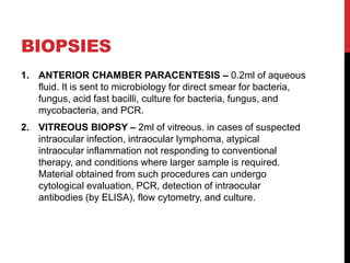 INVESTIGATIONS FOR UVEAL TRACT DISEASES.pptx