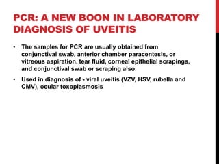 INVESTIGATIONS FOR UVEAL TRACT DISEASES.pptx