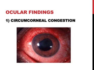 INVESTIGATIONS FOR UVEAL TRACT DISEASES.pptx