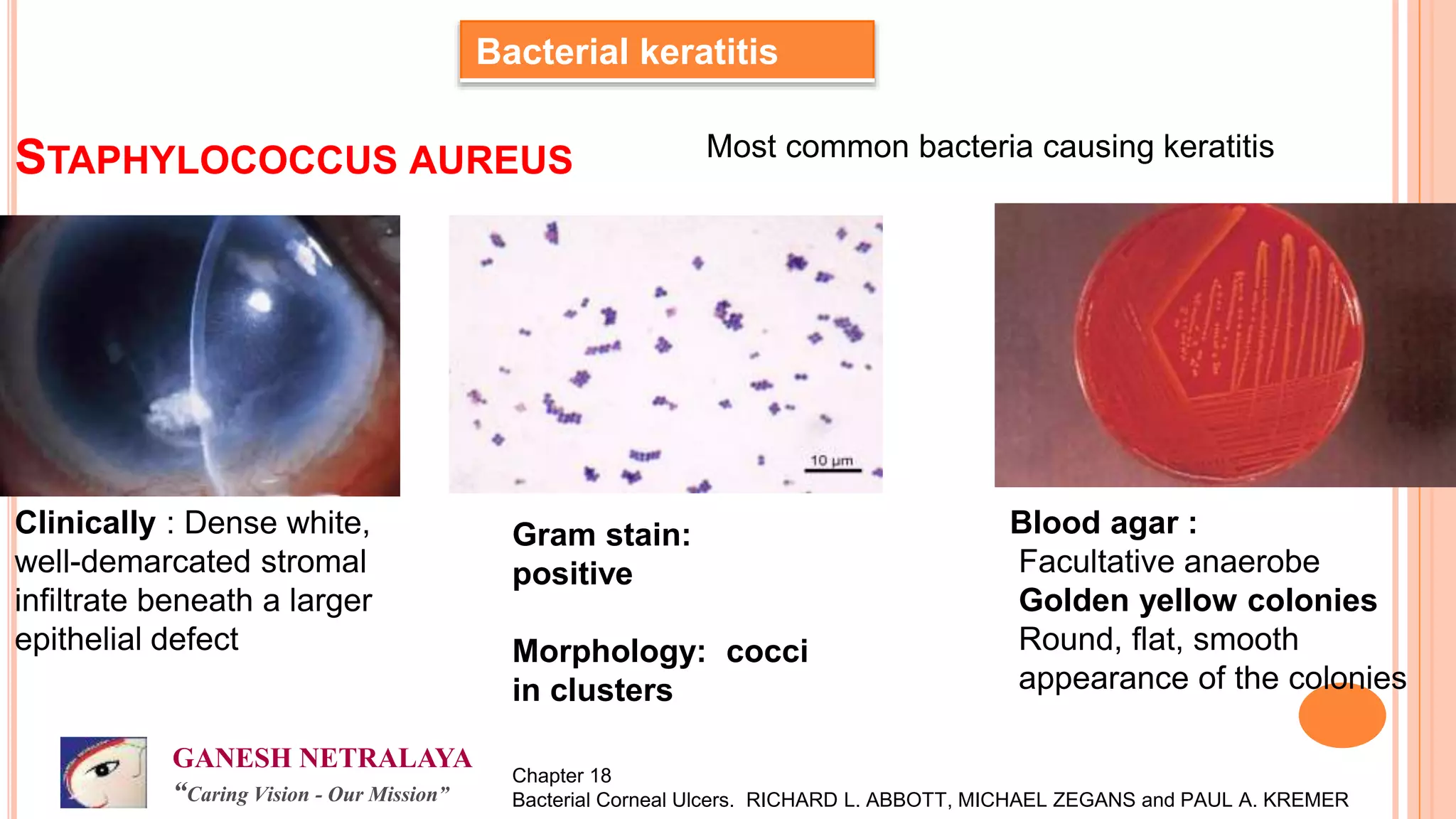 Investigations in a case of corneal ulcer in a clinic setting what to ...