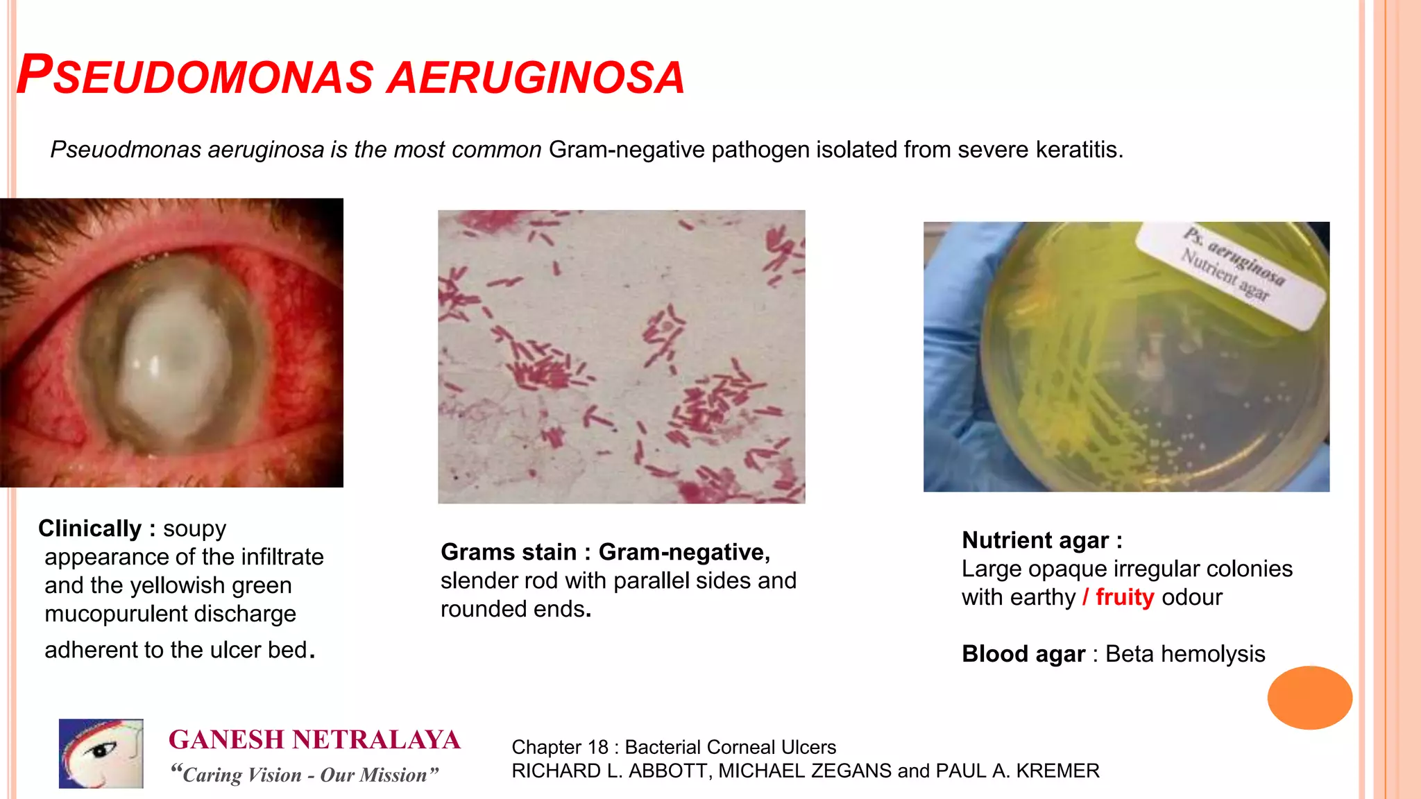 Investigations in a case of corneal ulcer in a clinic setting what to ...
