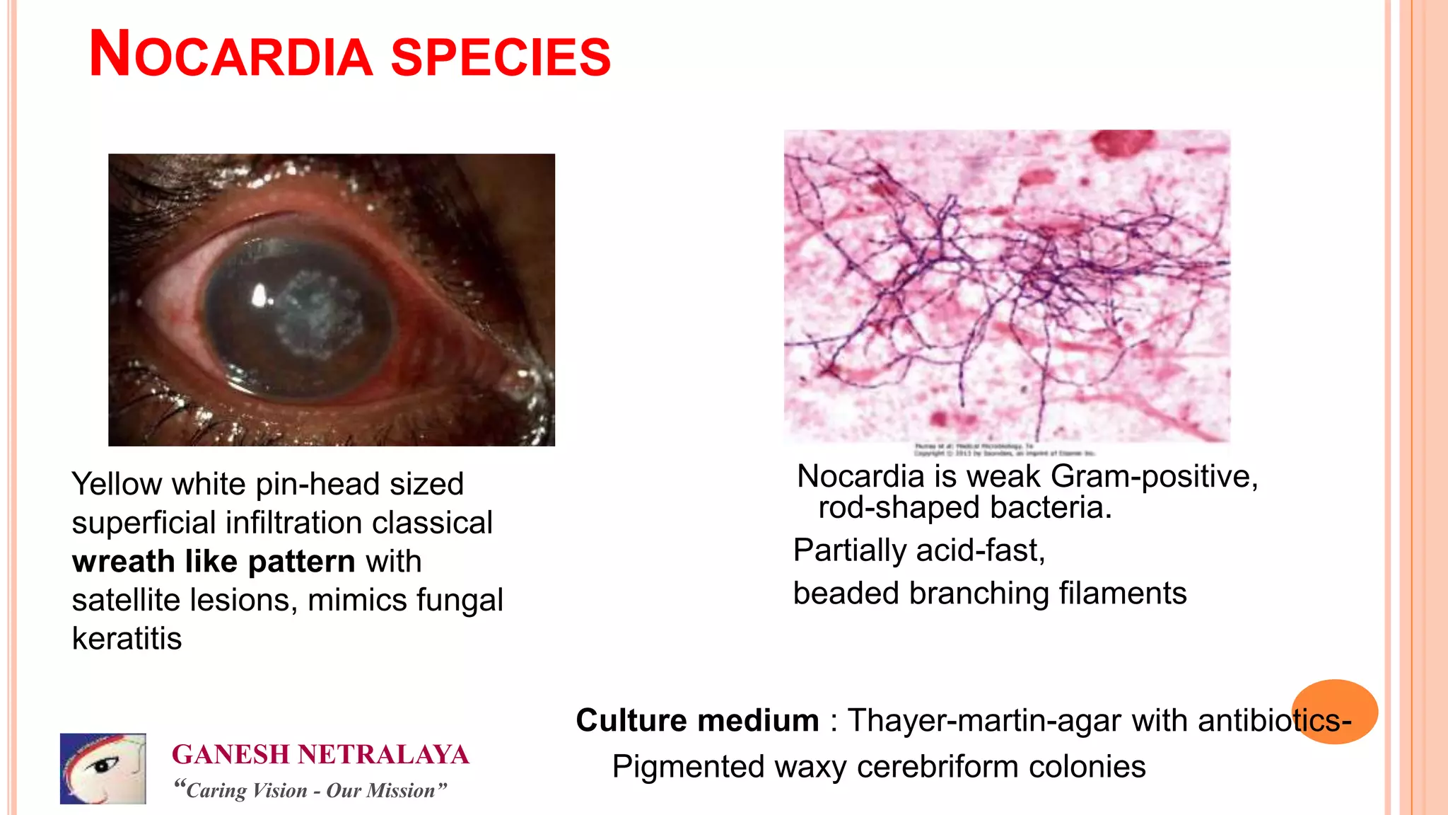 Investigations in a case of corneal ulcer in a clinic setting what to ...