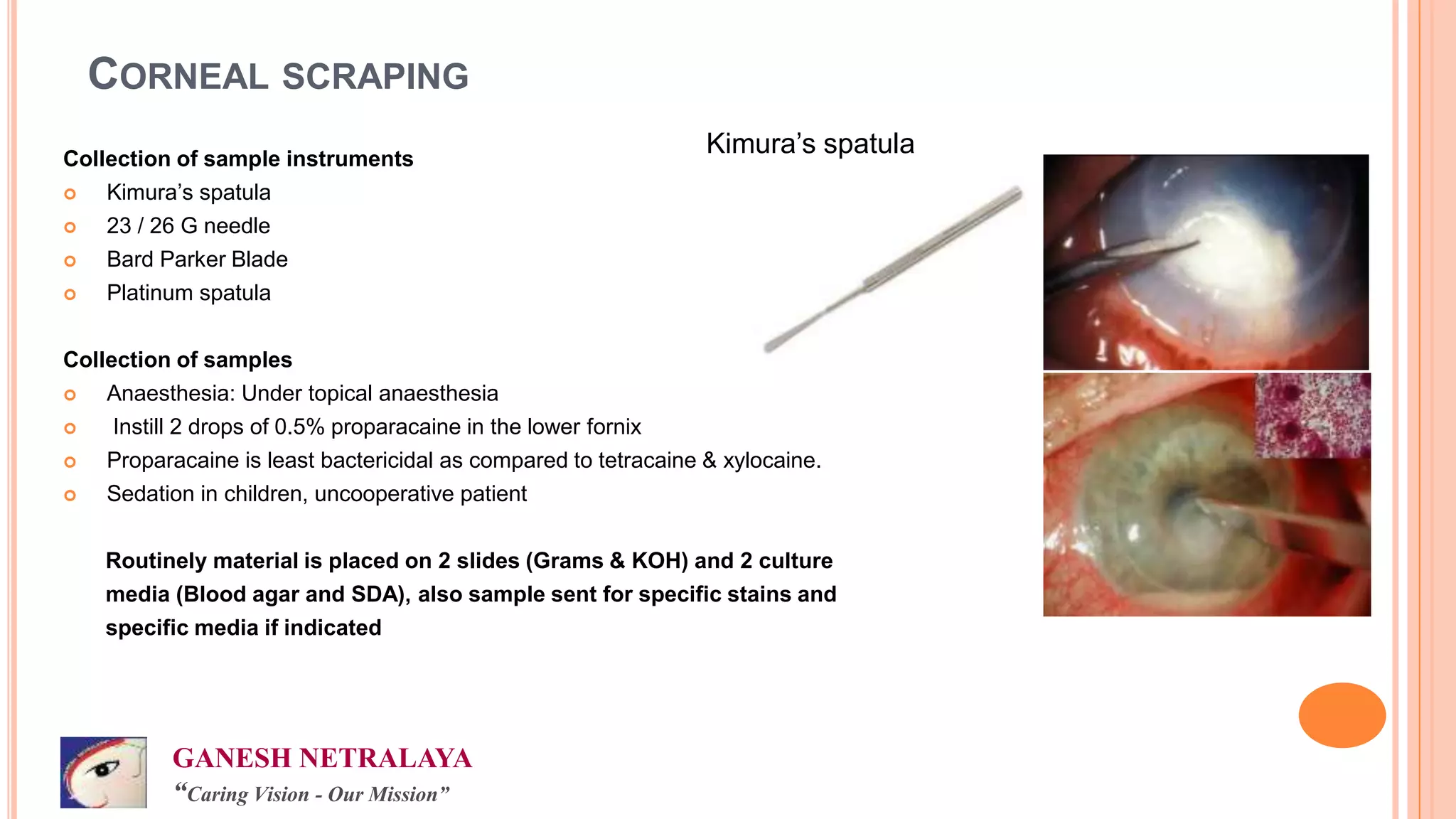 Investigations in a case of corneal ulcer in a clinic setting what to ...