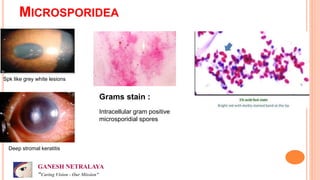 Investigations in a case of corneal ulcer in a clinic setting what to ...