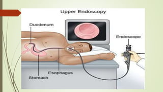 INVESTIGATIONS IN GASTRO-ENTEROLOGY AND HEPATOLOGY.pptx
