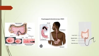 INVESTIGATIONS IN GASTRO-ENTEROLOGY AND HEPATOLOGY.pptx