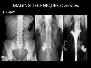 Investigations in gynaecology | PPT