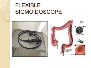 Investigations in lower gastrointestinal bleed | PPTX