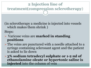 Investigations & management of varicose veins | PPTX