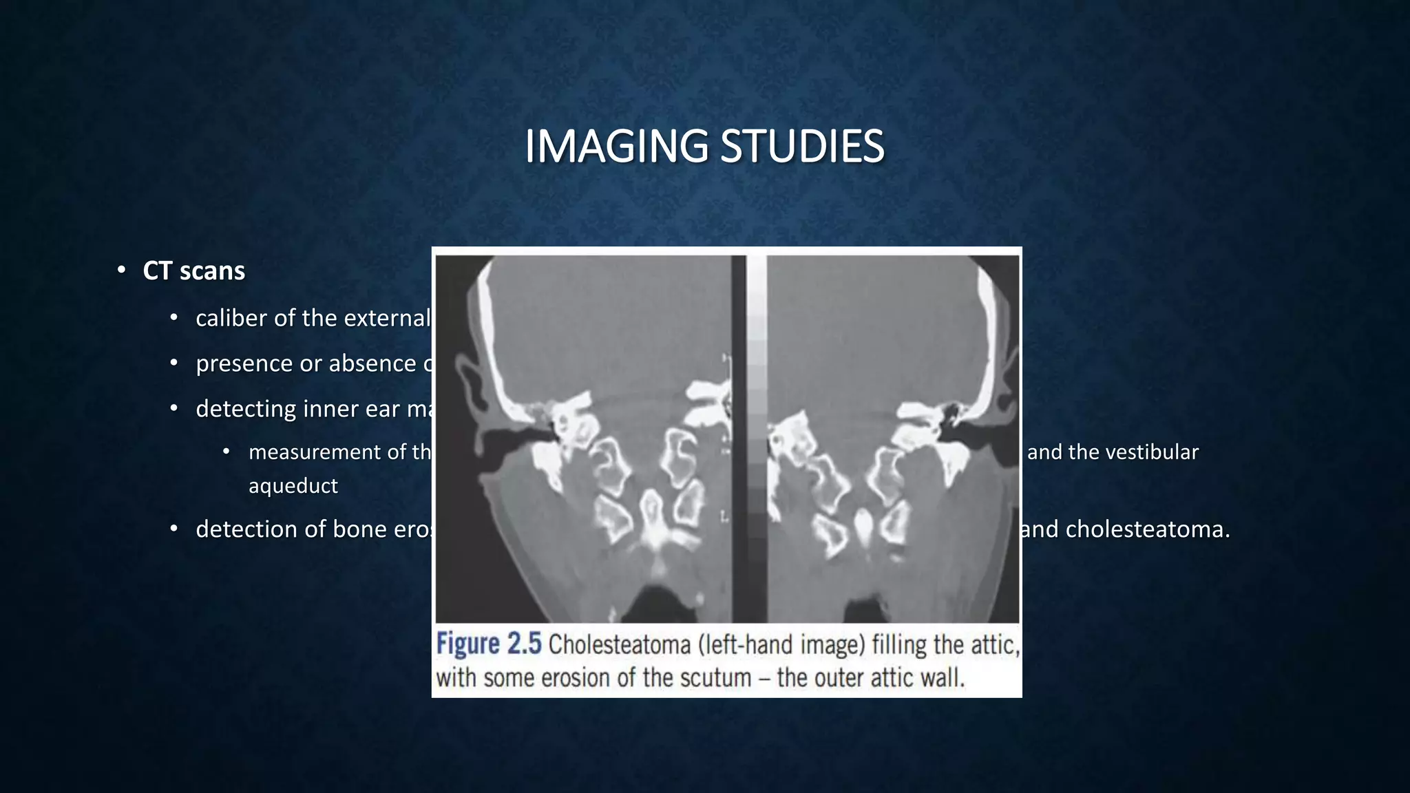 Investigations of Sensorineural hearing loss (SNHL) | PPTX