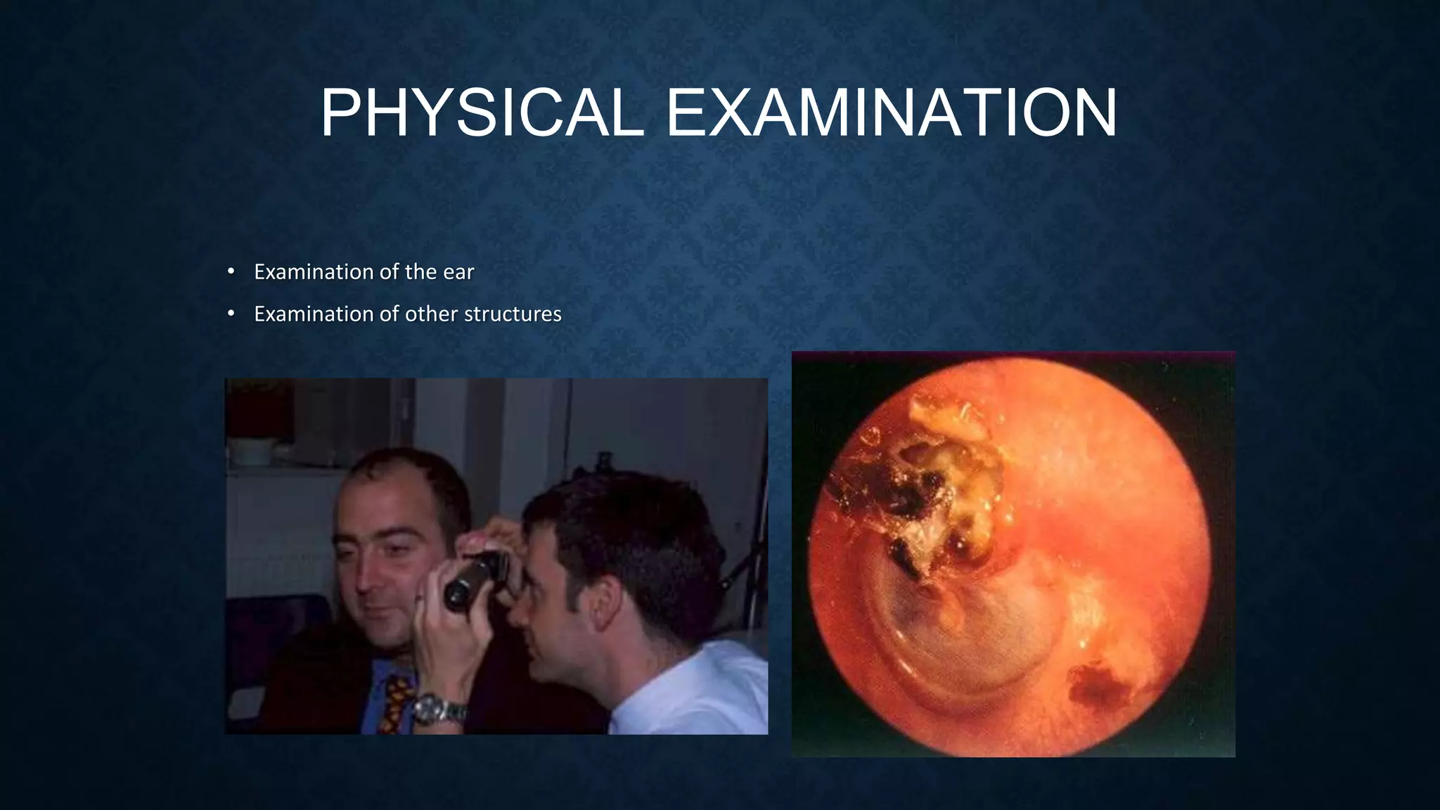 Investigations of Sensorineural hearing loss (SNHL) | PPTX