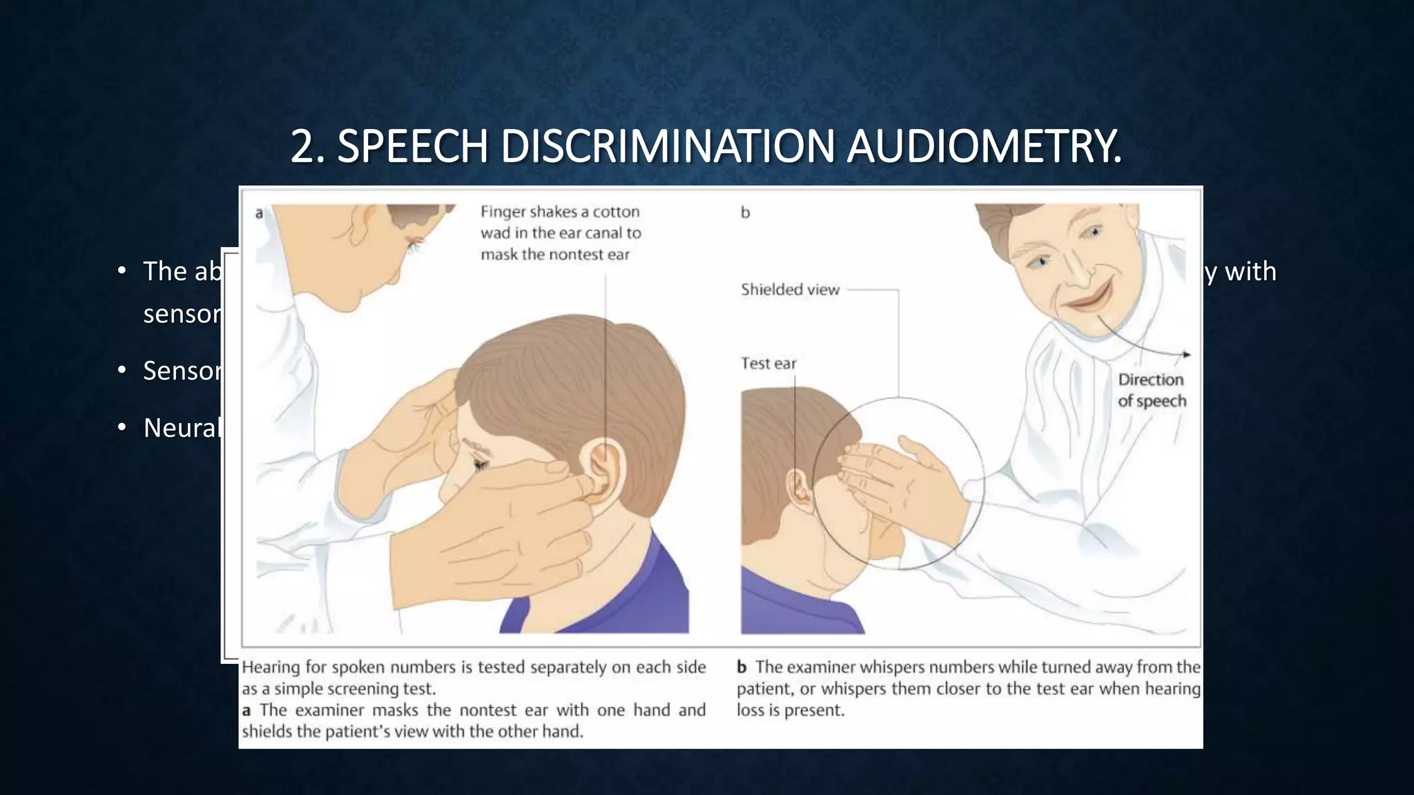 Investigations of Sensorineural hearing loss (SNHL) | PPTX