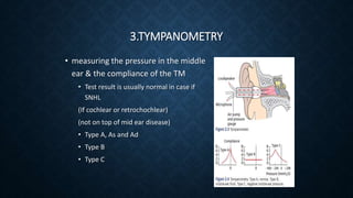 Investigations of Sensorineural hearing loss (SNHL) | PPTX