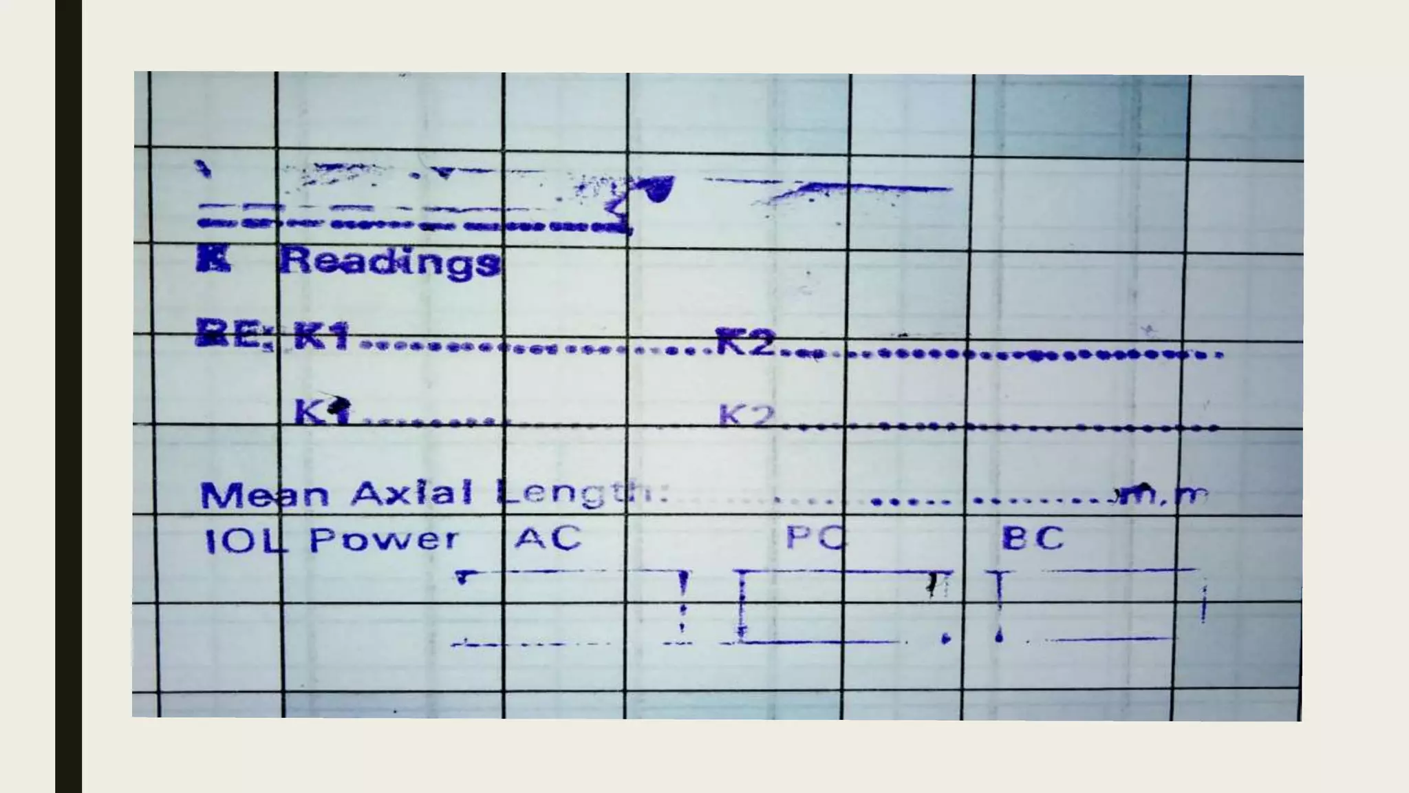 Investigations required for cataract evaluation | PPTX