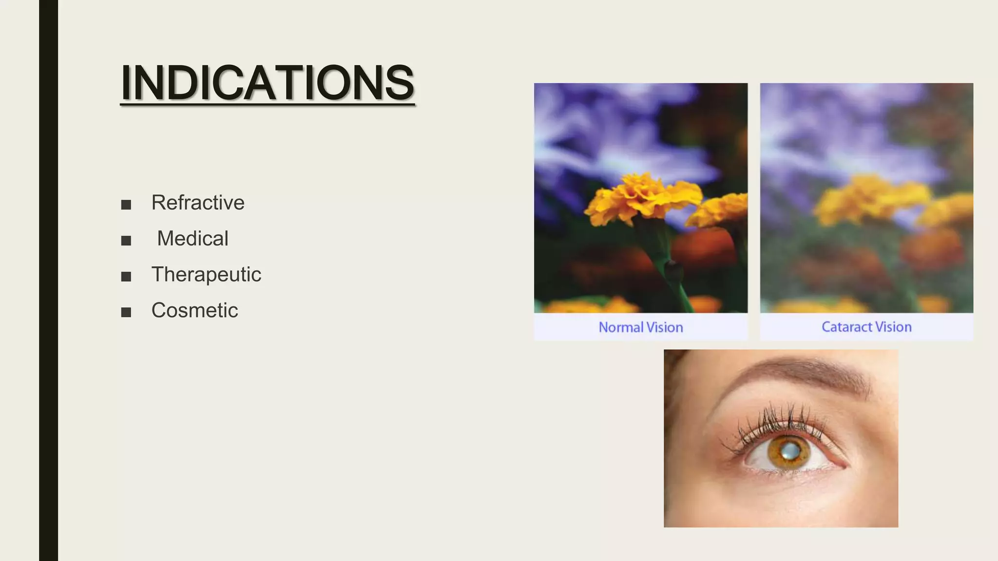 Investigations Required For Cataract Evaluation Pptx