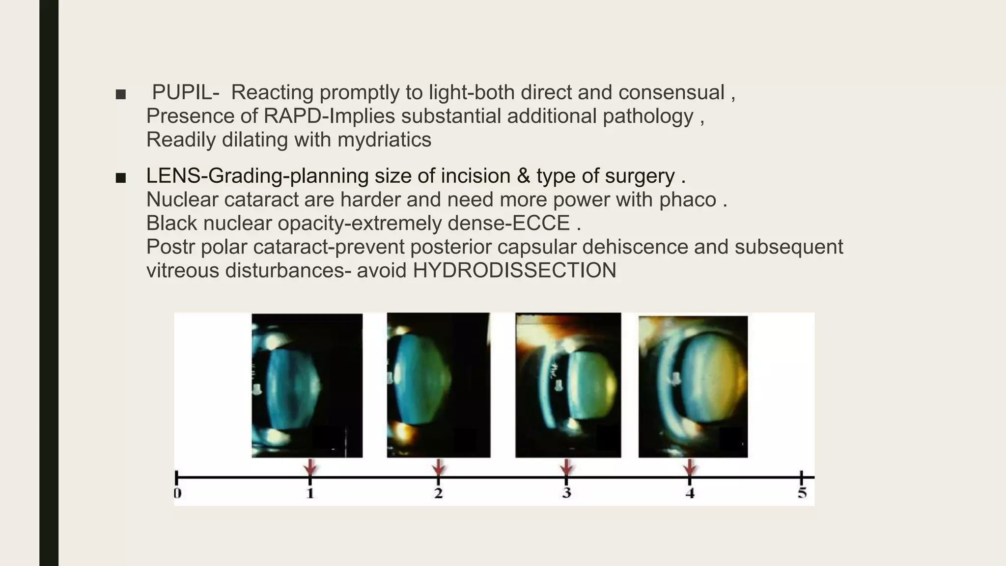 Investigations required for cataract evaluation | PPTX
