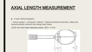 Investigations required for cataract evaluation | PPTX