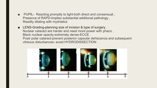 Investigations required for cataract evaluation | PPT