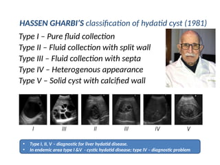 HYDATID CYST.03