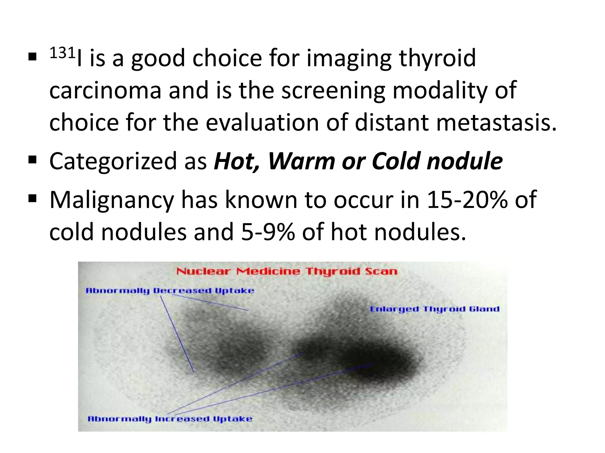 Investigations thyroid carcinoma | PPTX