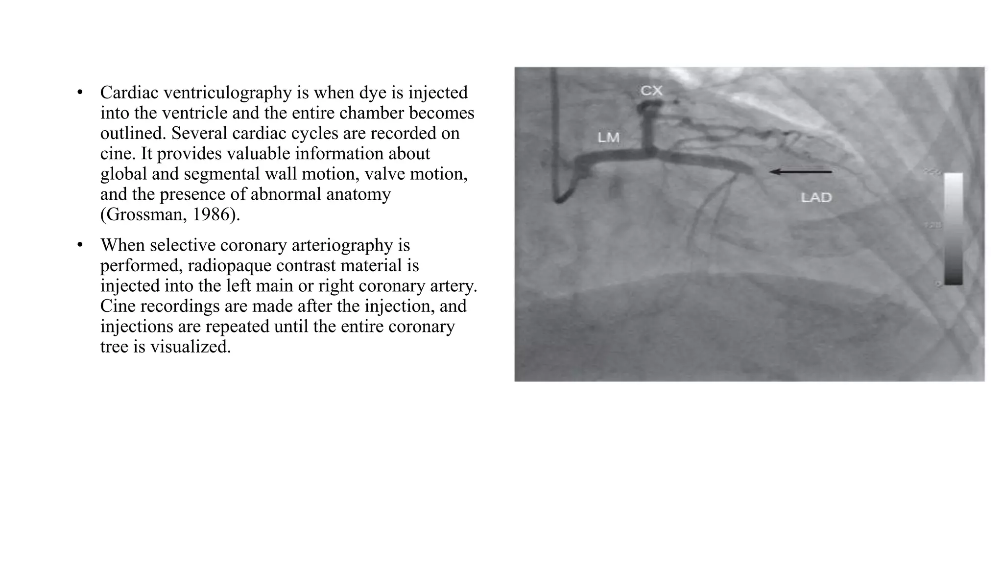 Investigative procedures in cardiac diseases. | PPTX