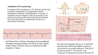 Investigative procedures in cardiac diseases. | PPTX
