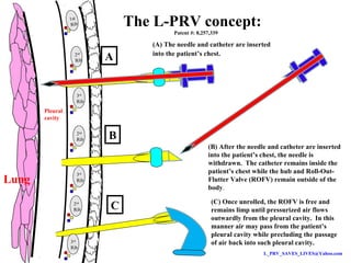 Investment l prv | PPT