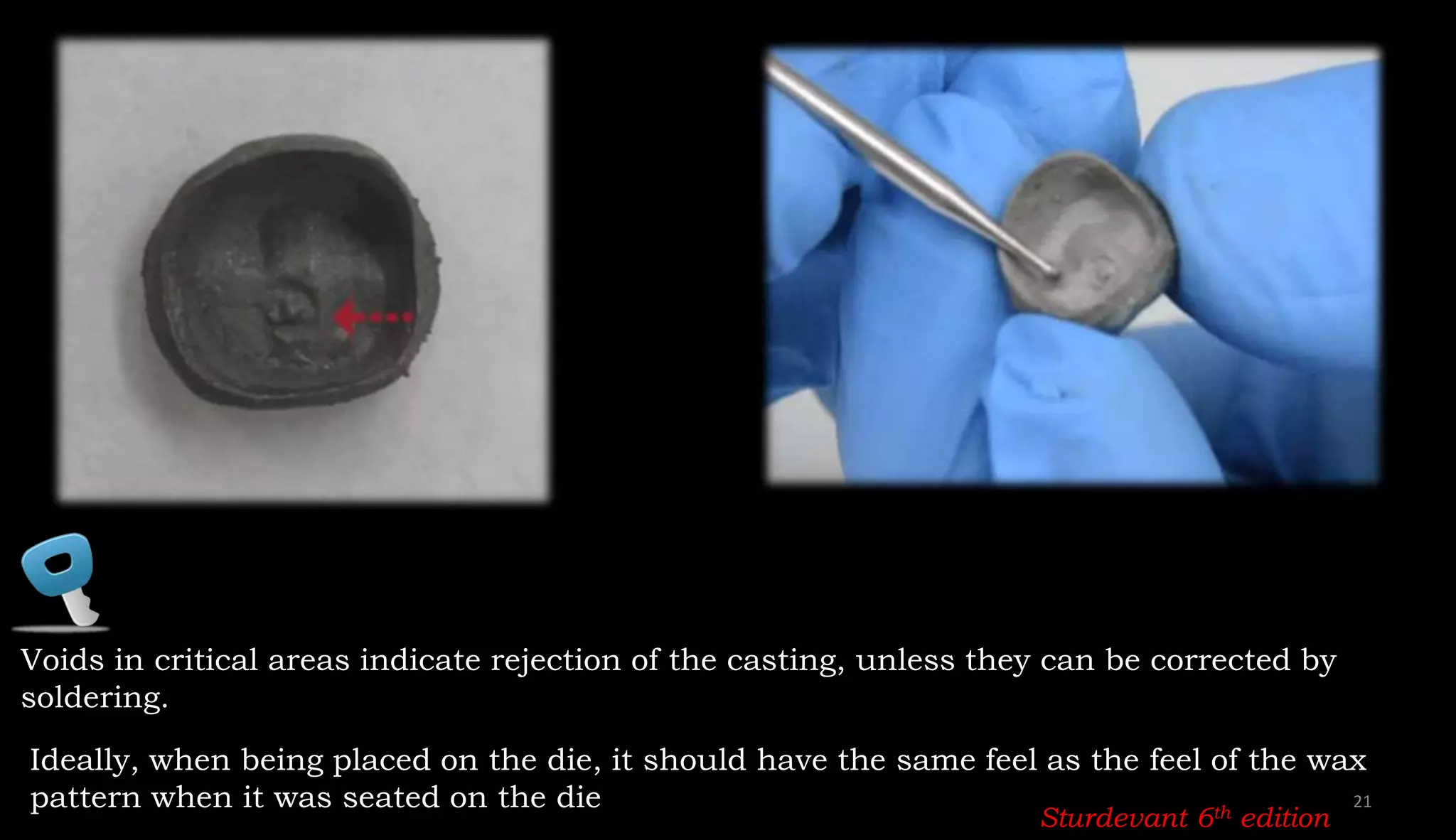 CEMENTATION OF INLAY AND VARIOUS TECHNIQUE FOR TEMPORIZATION | PPTX