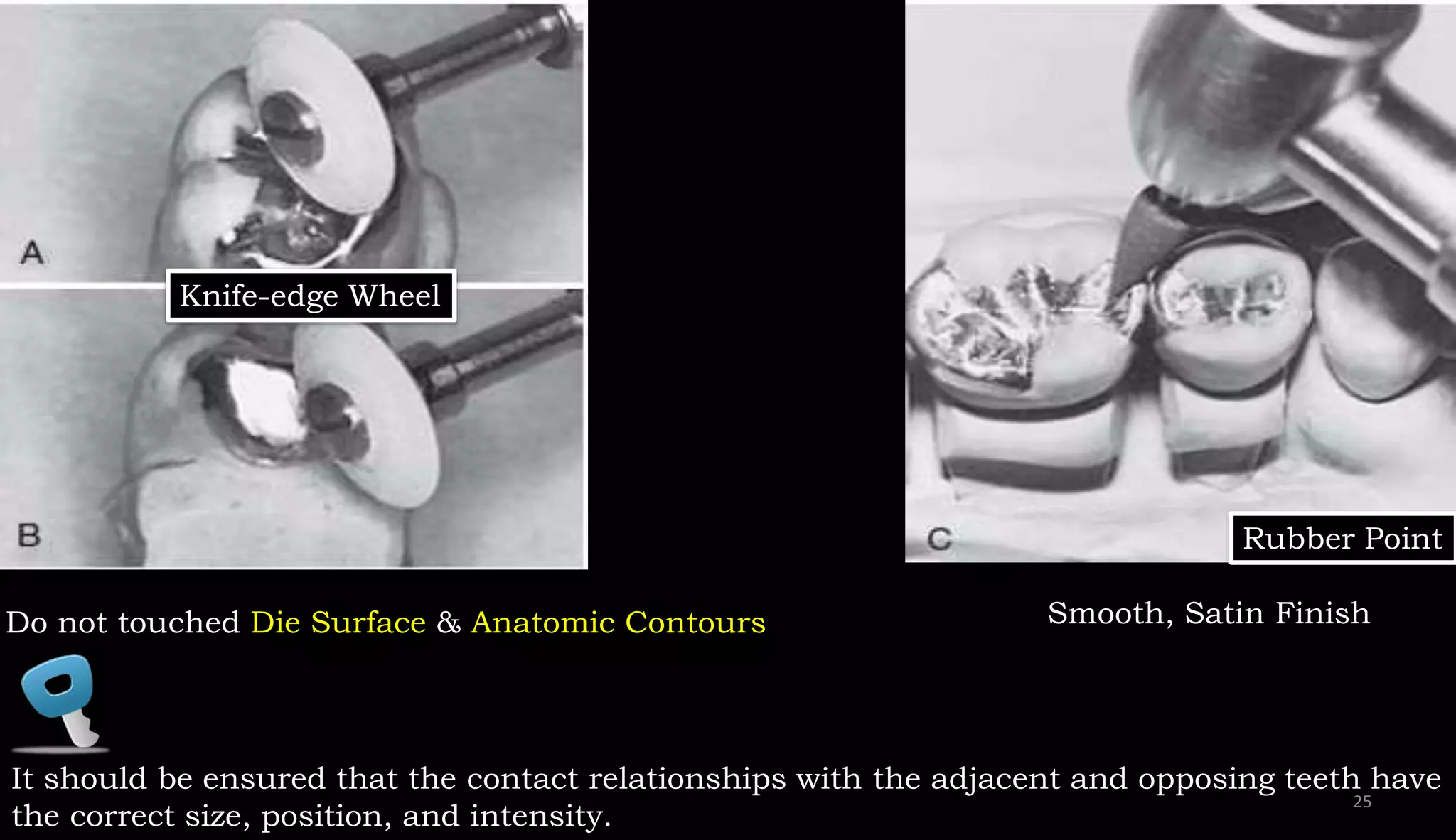 CEMENTATION OF INLAY AND VARIOUS TECHNIQUE FOR TEMPORIZATION | PPTX