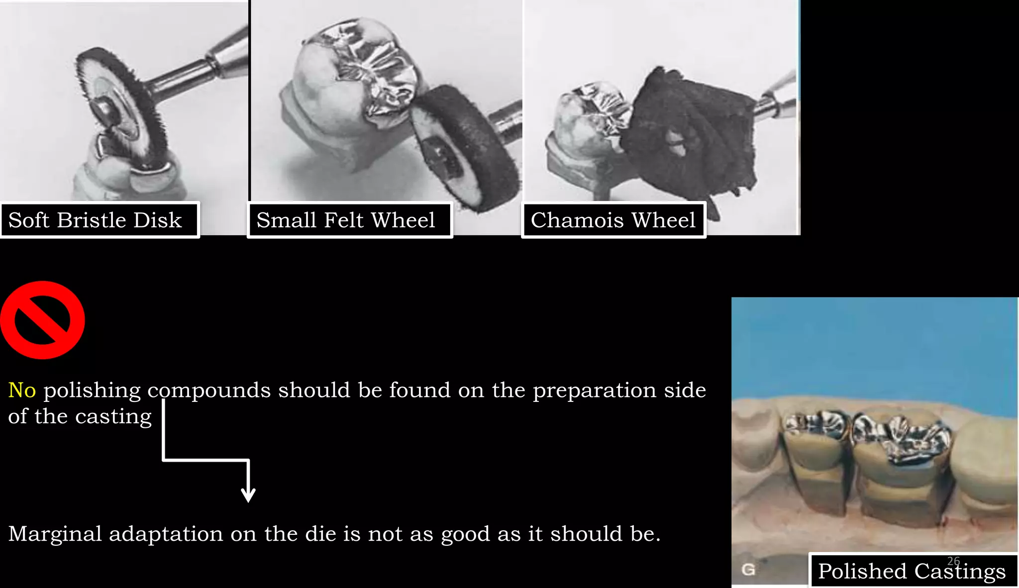 CEMENTATION OF INLAY AND VARIOUS TECHNIQUE FOR TEMPORIZATION | PPTX