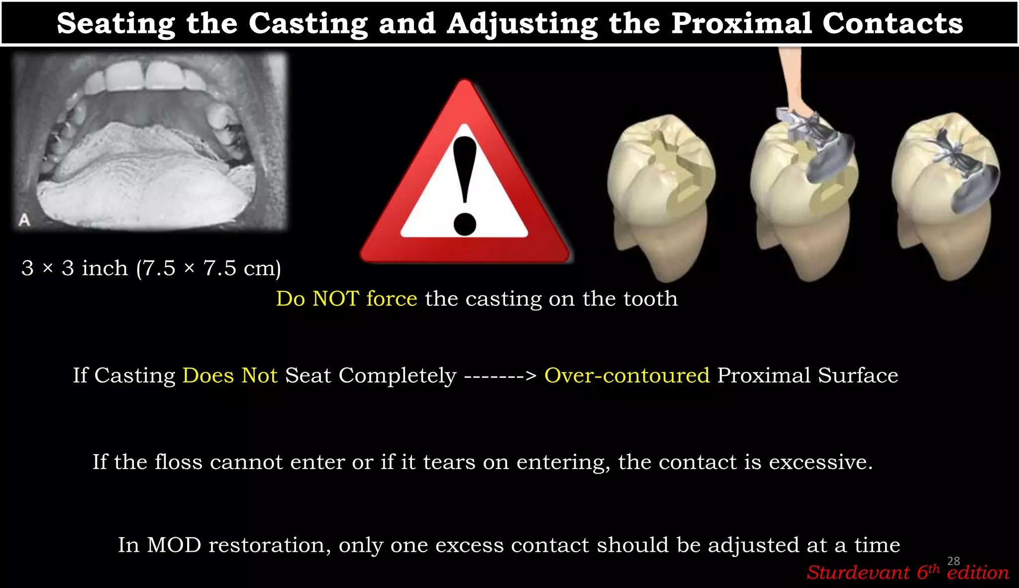 CEMENTATION OF INLAY AND VARIOUS TECHNIQUE FOR TEMPORIZATION | PPTX