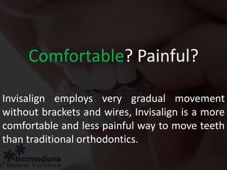 All about INVISALIGN | PPTX