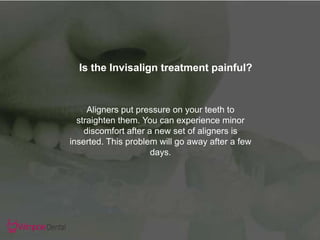 Invisalign FAQS | PPTX