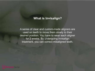 Invisalign FAQS | PPTX