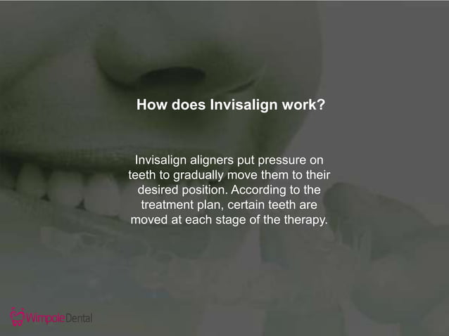 Invisalign FAQS | PPTX