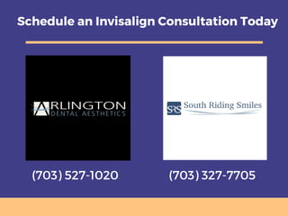 Your Guide to Invisalign | PDF