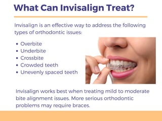 Your Guide to Invisalign | PDF