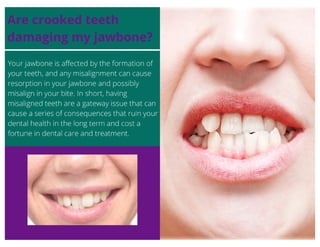 Invisalign can change your life by reshaping your smile into what you ...