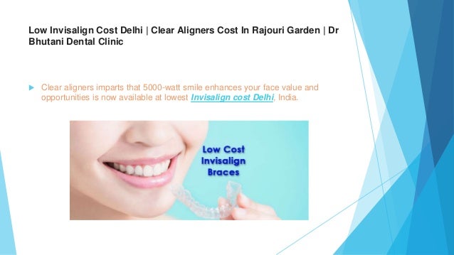 Low Invisalign Cost Delhi | Clear Aligners Cost In Rajouri Garden | Dr ...