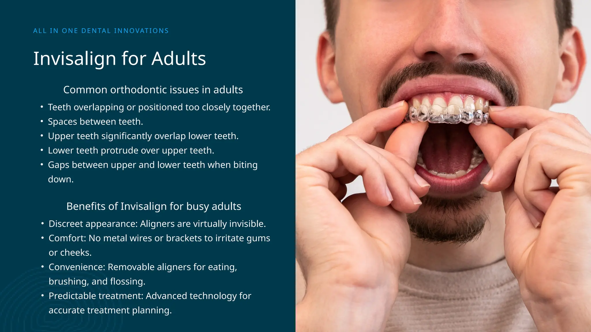 Invisalign for Different Age Groups iin Dublin, CA.pptx