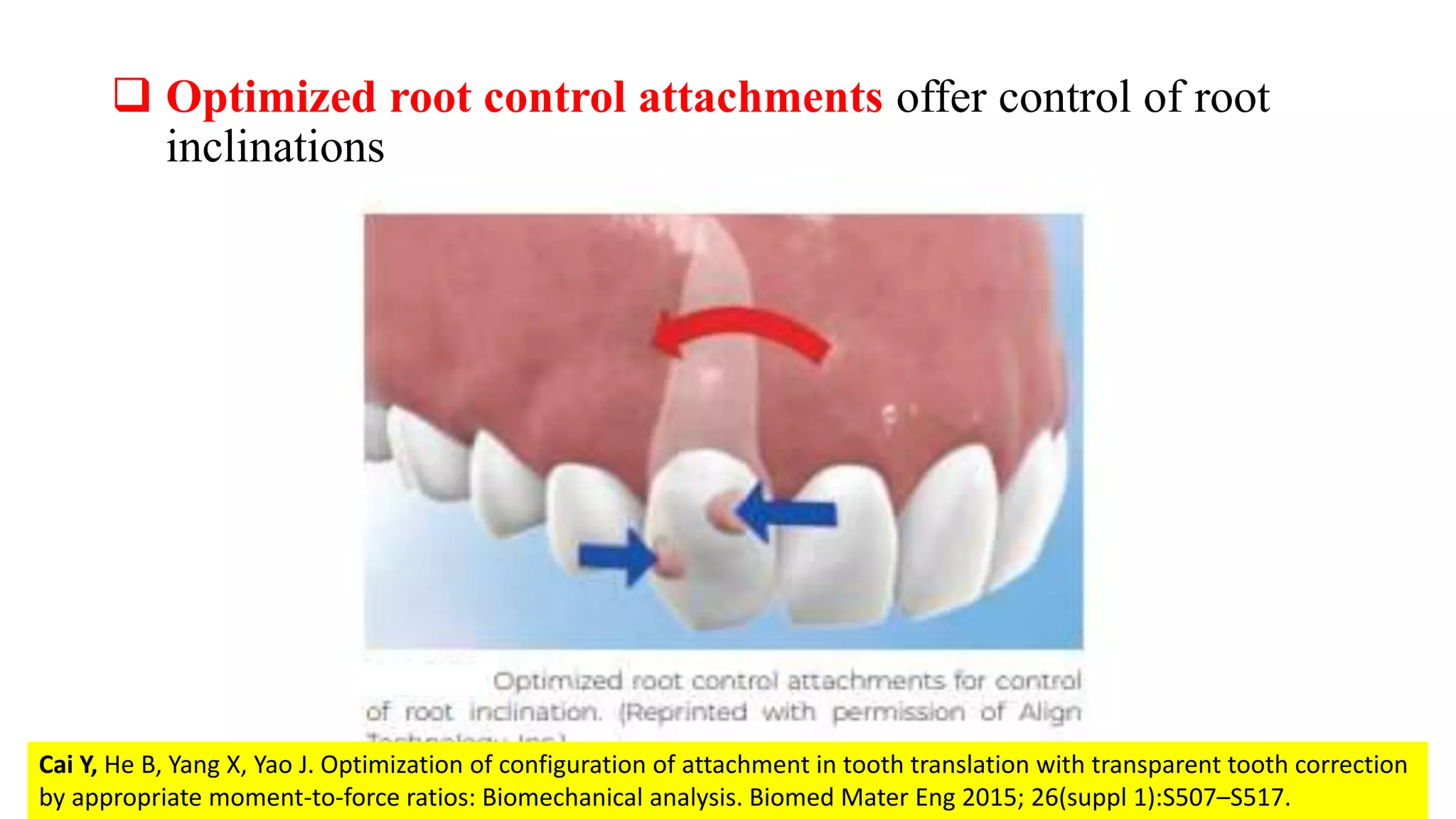 Invisalign in pediatric dentistry | PPTX