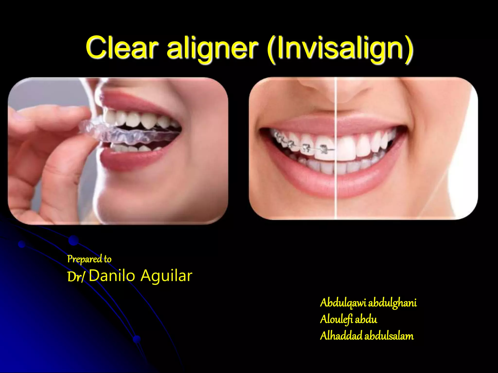 invisalign Pereperd by dr.abdulghani ,Aloulefi .Alhaddad.ppt