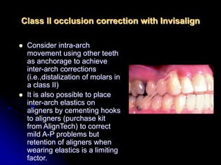 invisalign Pereperd by dr.abdulghani ,Aloulefi .Alhaddad.ppt