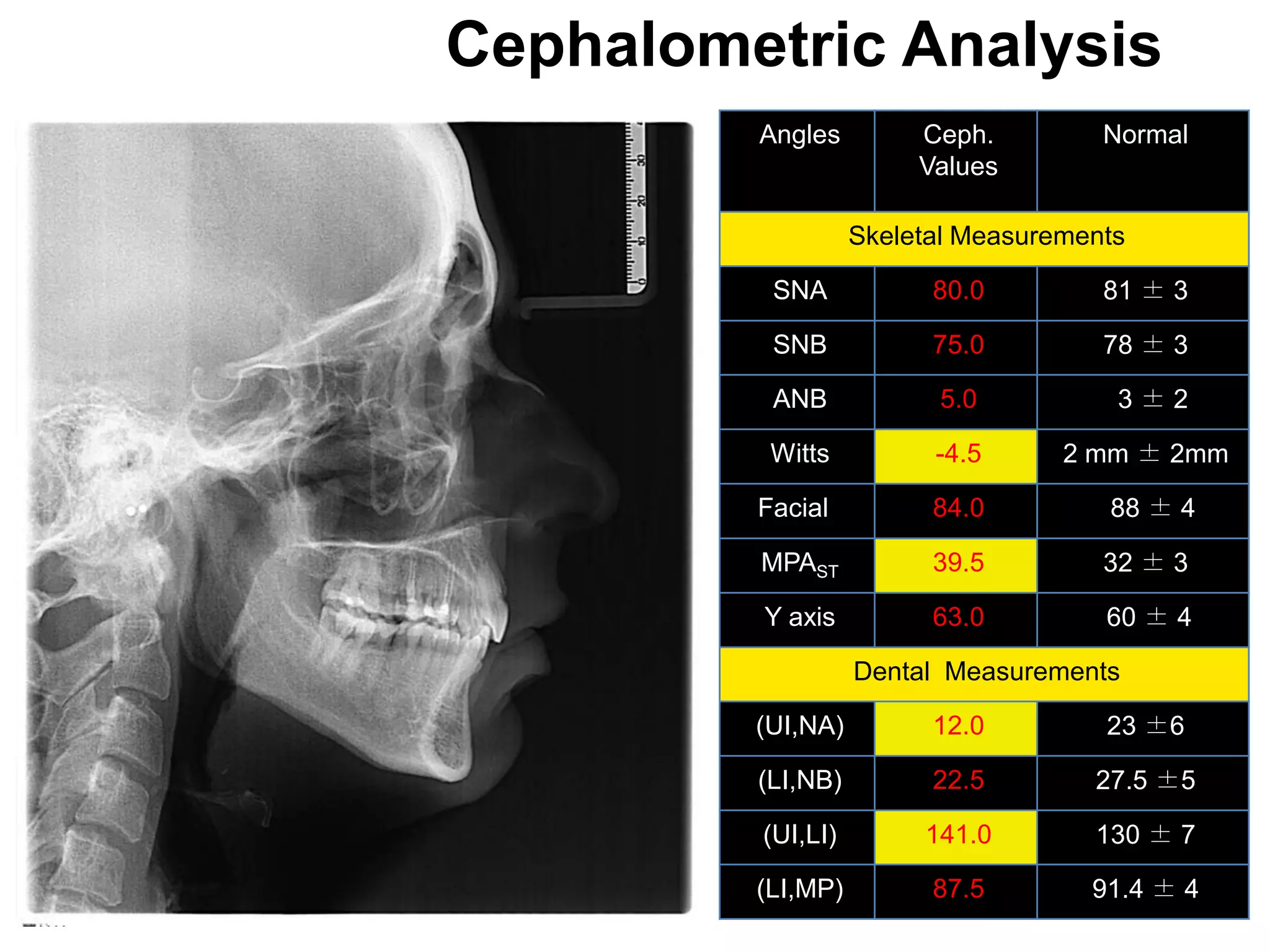 Invisalign presentation | PPTX