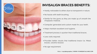 Invisalign treatment | PDF