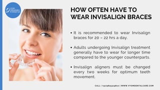 Invisalign treatment | PDF