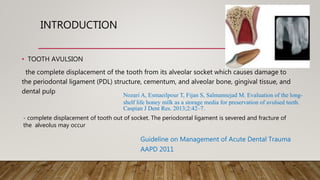 In vitro comparative evaluation of different storage media(hank's | PPTX