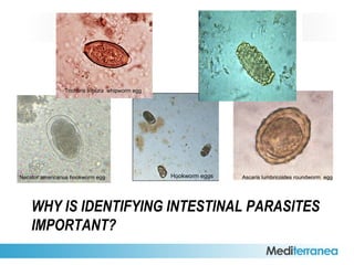Parasite In Stool