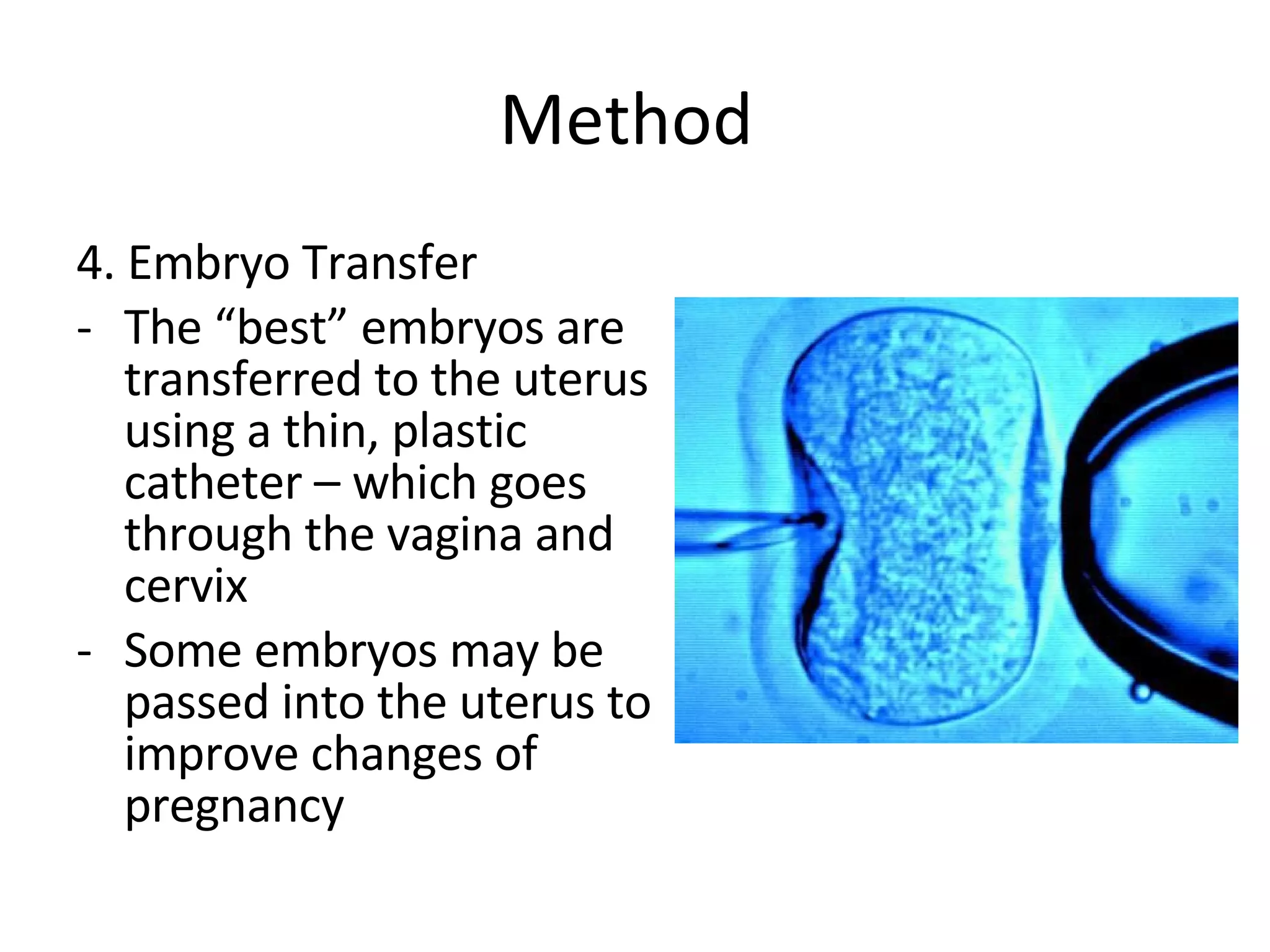 In Vitro Fertilization | PPT